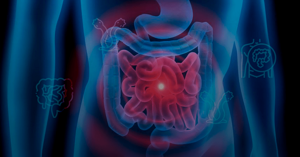 Lo que debes saber sobre los parásitos intestinales - Servicios Médicos ...